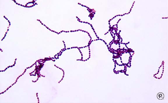 Streptococcus - JungleKey.fr Image #50